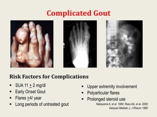 Gout, tophi and kidney disease | PPTX