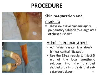Traumatic chest injury | PPTX