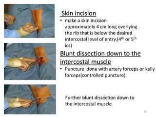 Traumatic chest injury | PPT