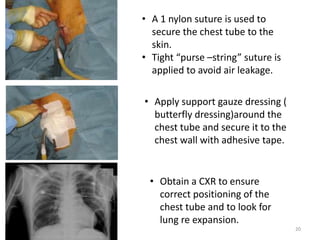Traumatic chest injury | PPT