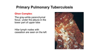 Infectiuos diseases | PPTX