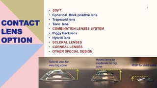contact lens fitting in keratoconnus | PPTX