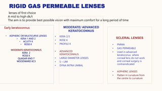 contact lens fitting in keratoconnus | PPTX