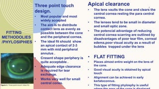 contact lens fitting in keratoconnus | PPTX