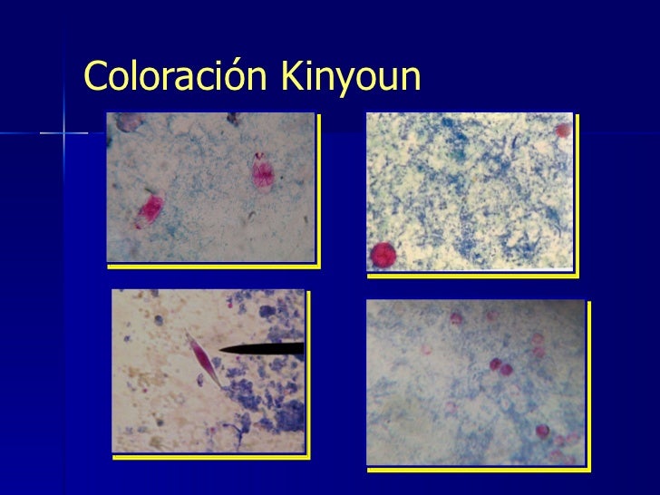 Practica 2 tecnicas coproparasitologicas