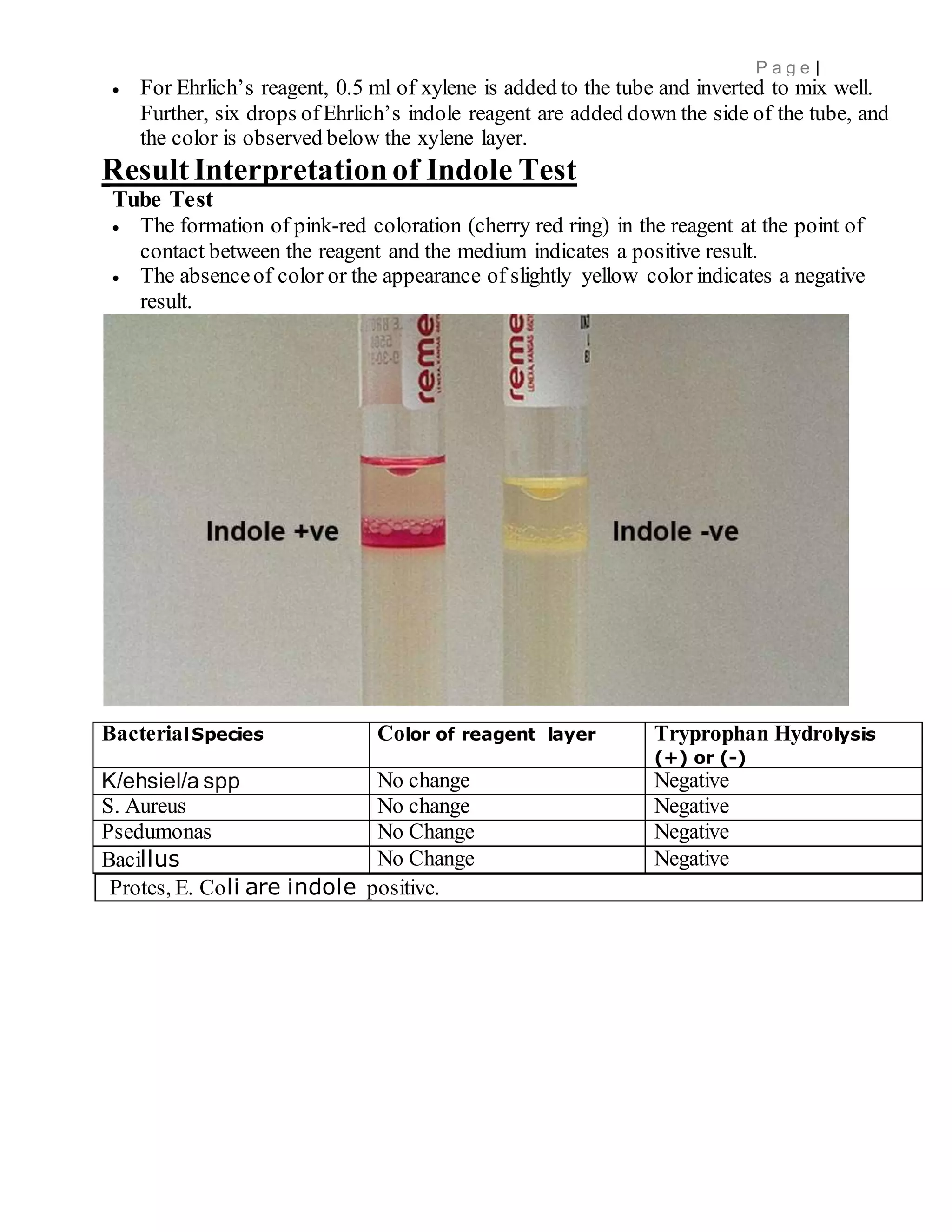 Carbohydrate Fermentation, Tripe Sugar Iron Agar Test, IMViC Test Part ...