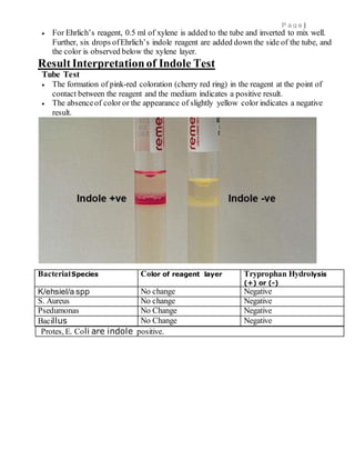 Carbohydrate Fermentation, Tripe Sugar Iron Agar Test, IMViC Test Part ...