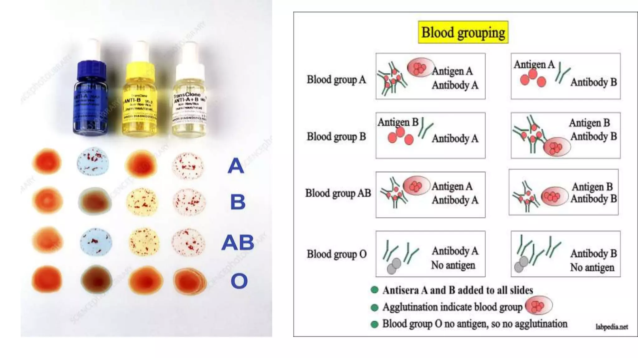 Practical 14 blood groups | PPTX