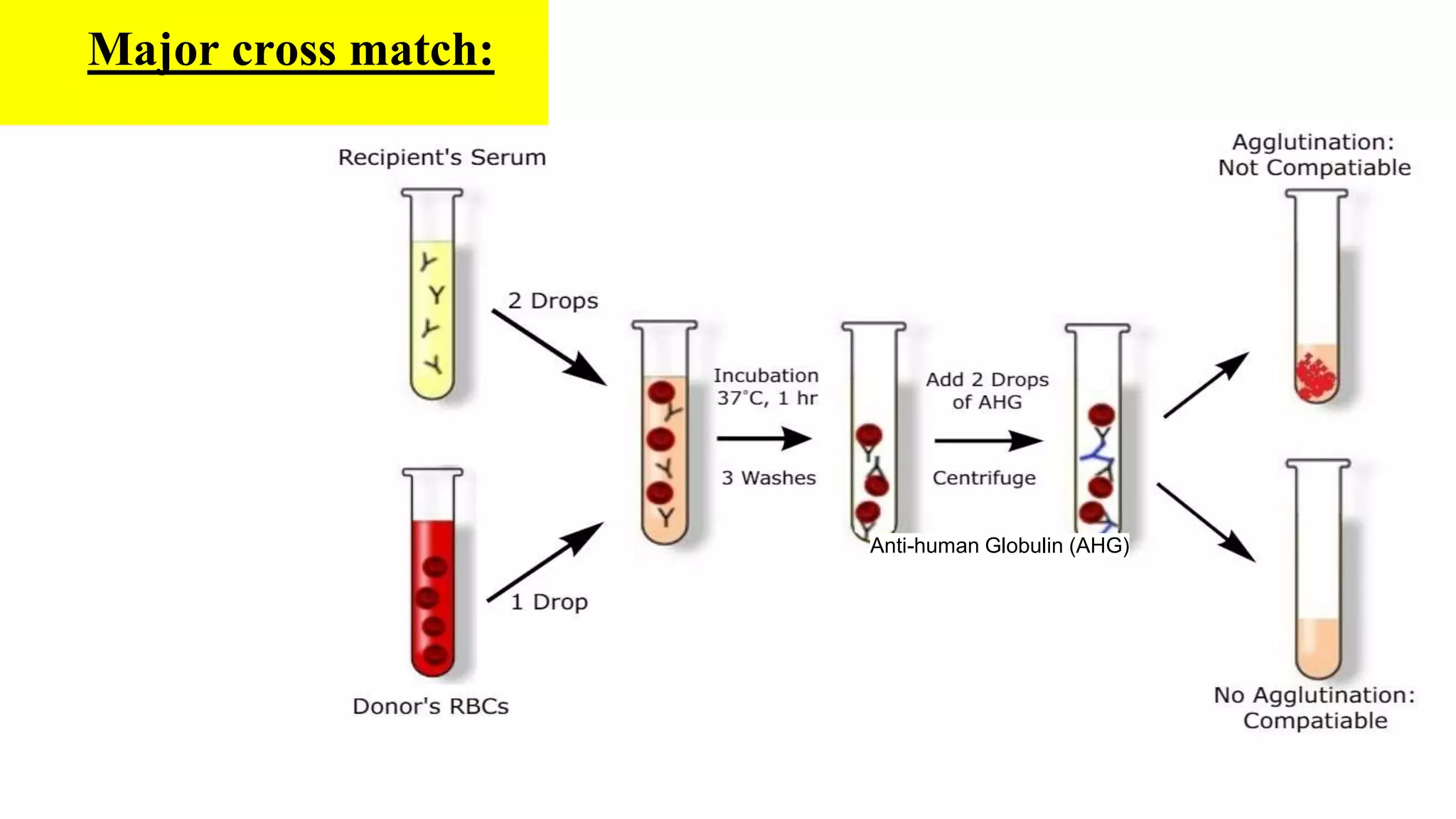 Practical 14 blood groups | PPTX