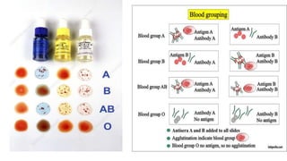 Practical 14 blood groups | PPTX
