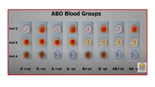 Practical 14 blood groups | PPTX