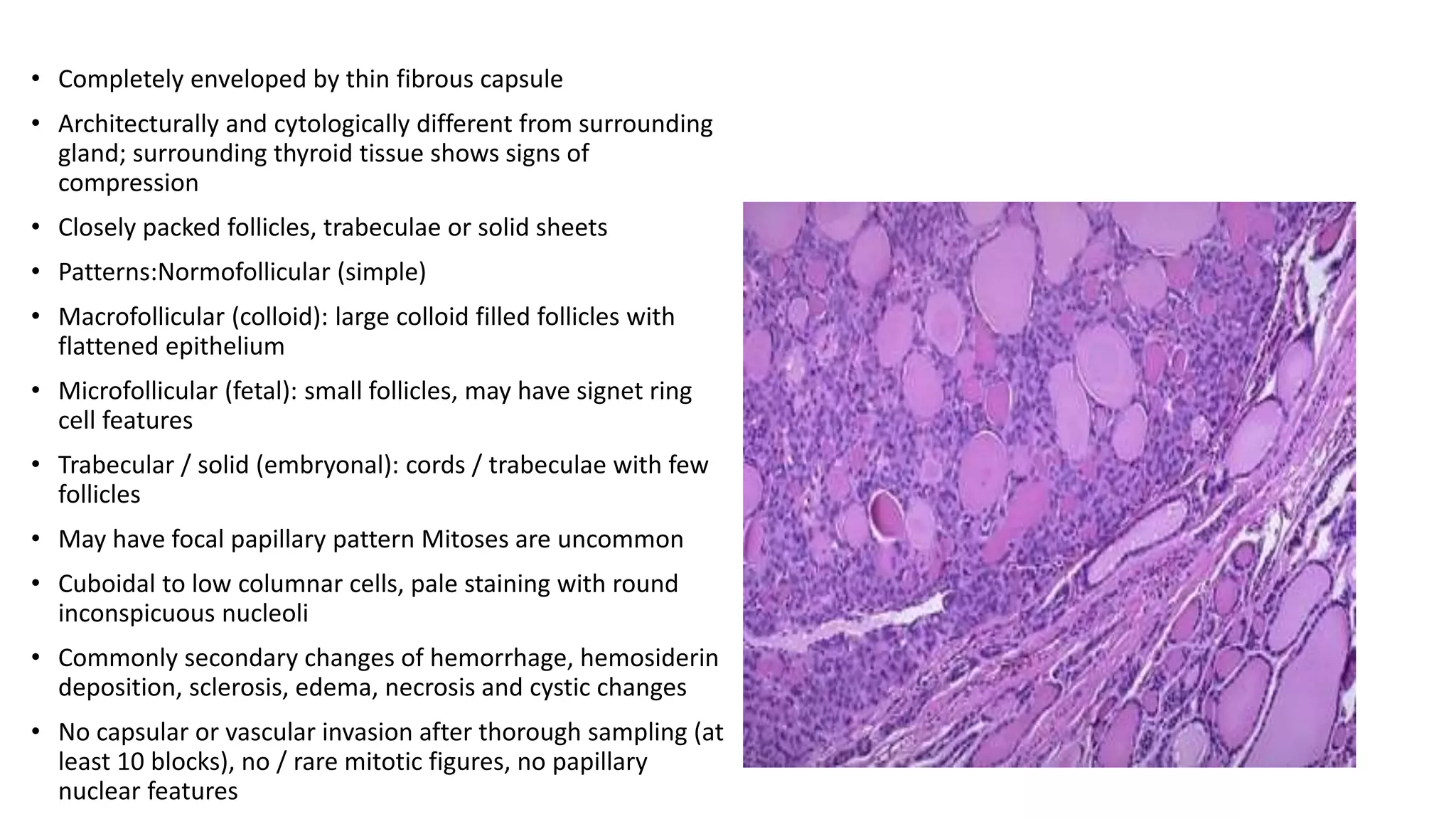Practical 3 thyroid pathology-2019 | PPTX