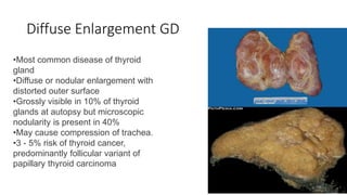 Practical 3 thyroid pathology-2019 | PPTX