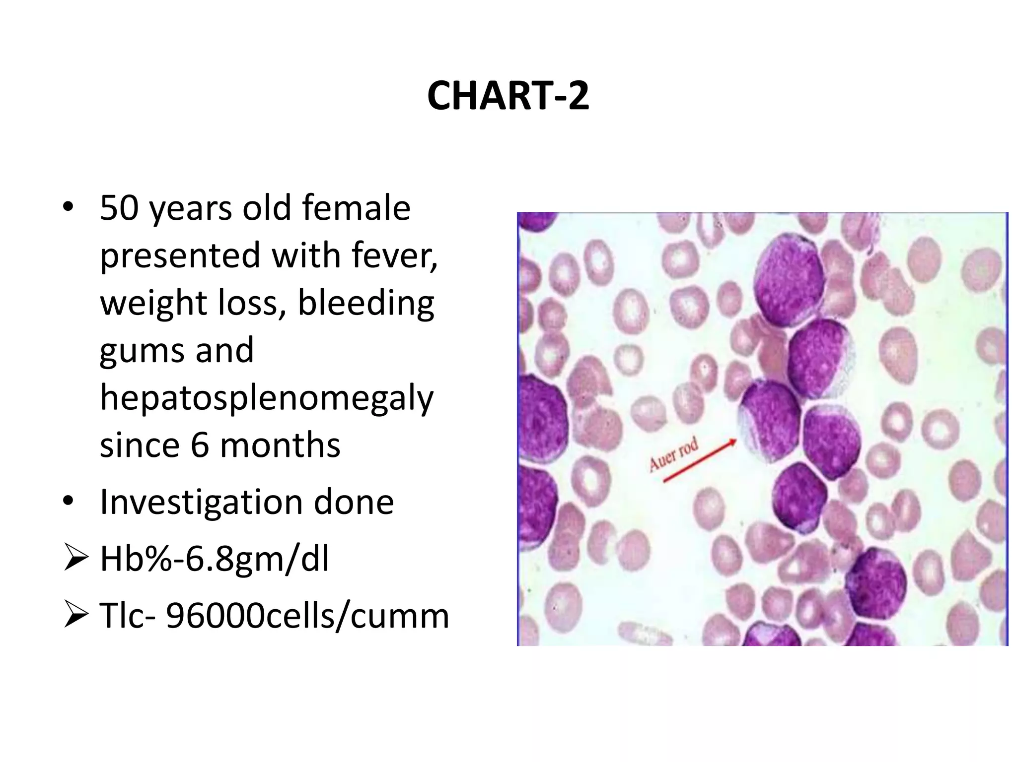 PRACTICAL-INVESTIGATION OF LEUKEMIA .pptx