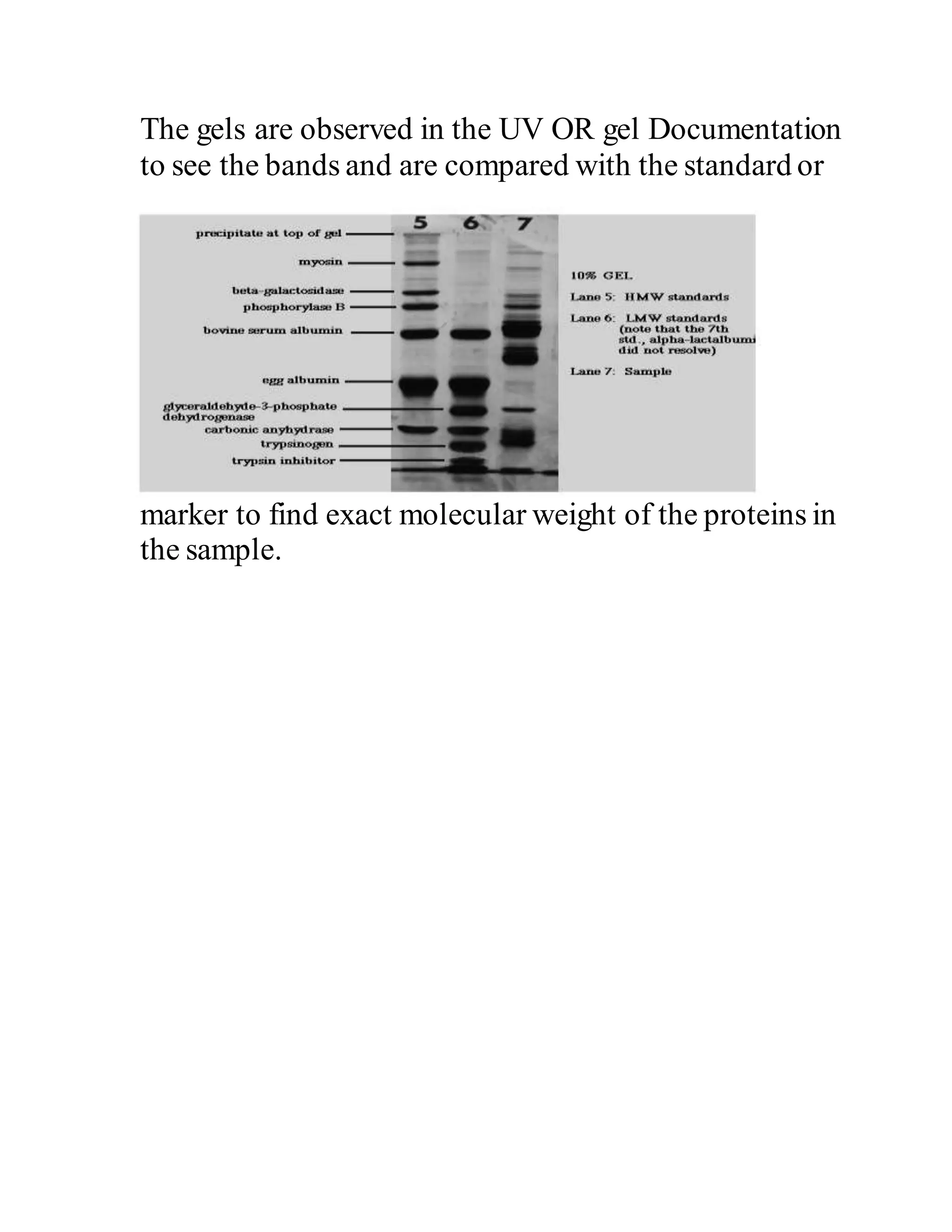 Running of SDS-PAGE Practical | DOCX