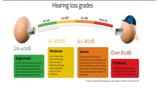 Practical 21 Hearing tests | PPTX