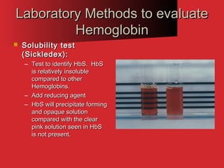 Hemoglobin Electrophoresis (Biochemistry) | PPT