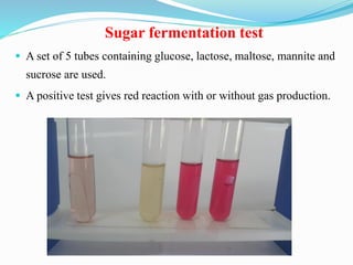 Practical 40 biochemical test microbiology.pdf