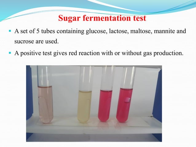 Practical 40 biochemical test microbiology.pdf