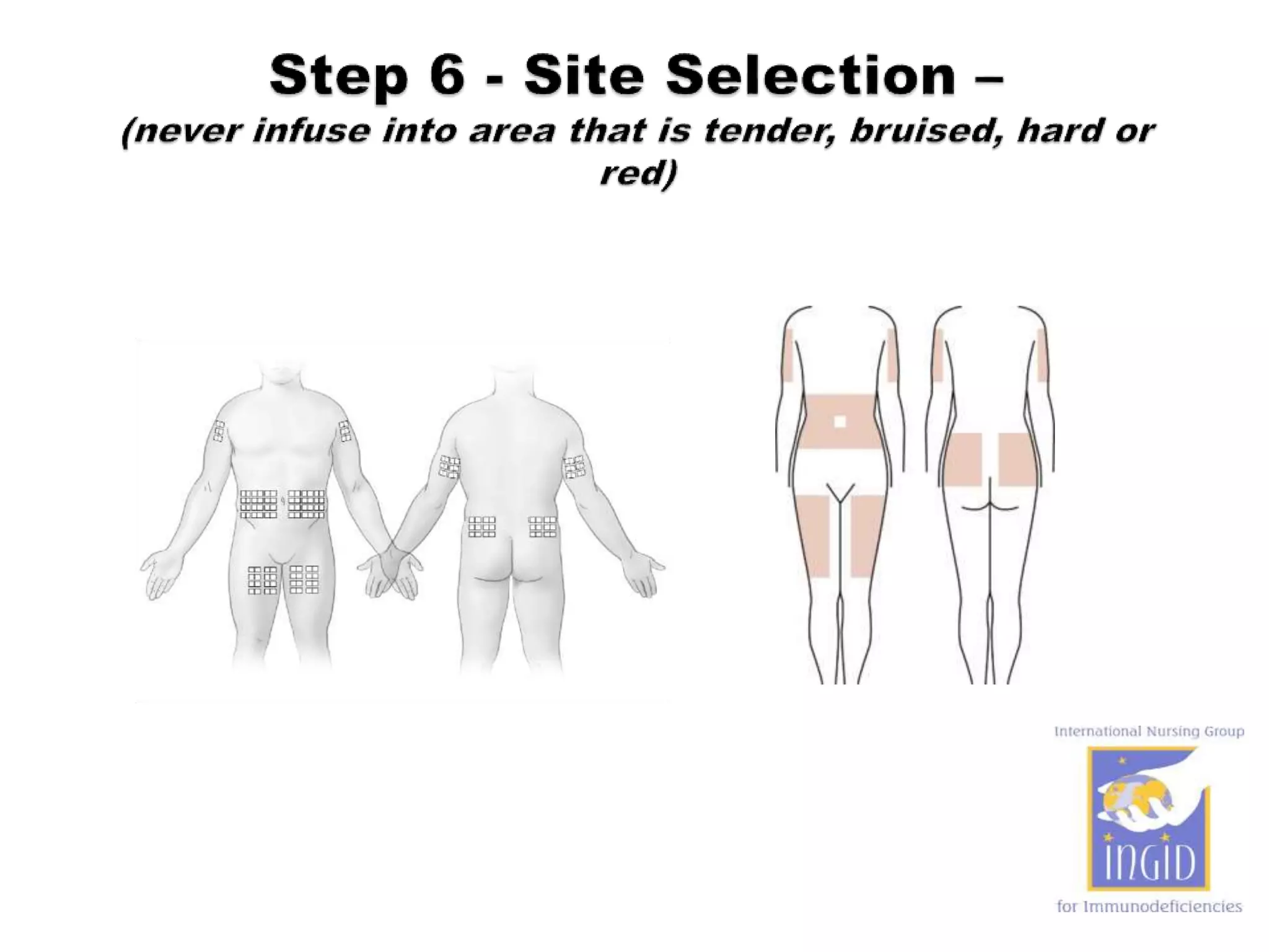 Practical administration Push Method 2019.pptx