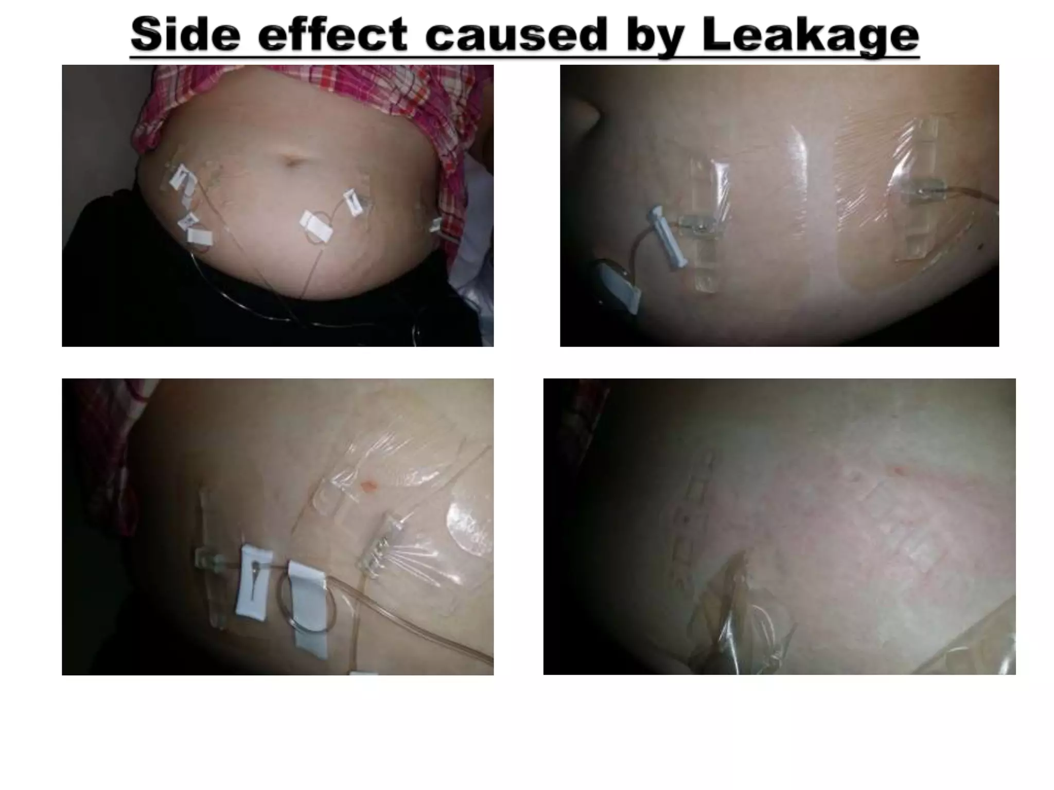 Practical administration Push Method 2019.pptx