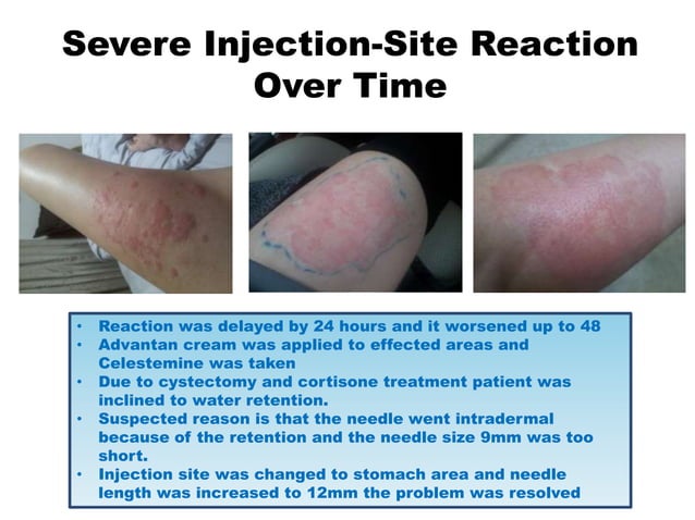 Practical administration Push Method 2019.pptx