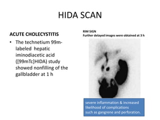 Practical approach to fever with altered liver functions | PPTX