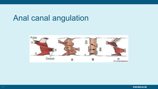 Practical bowel management in MS - Maureen Coggrave | PPTX