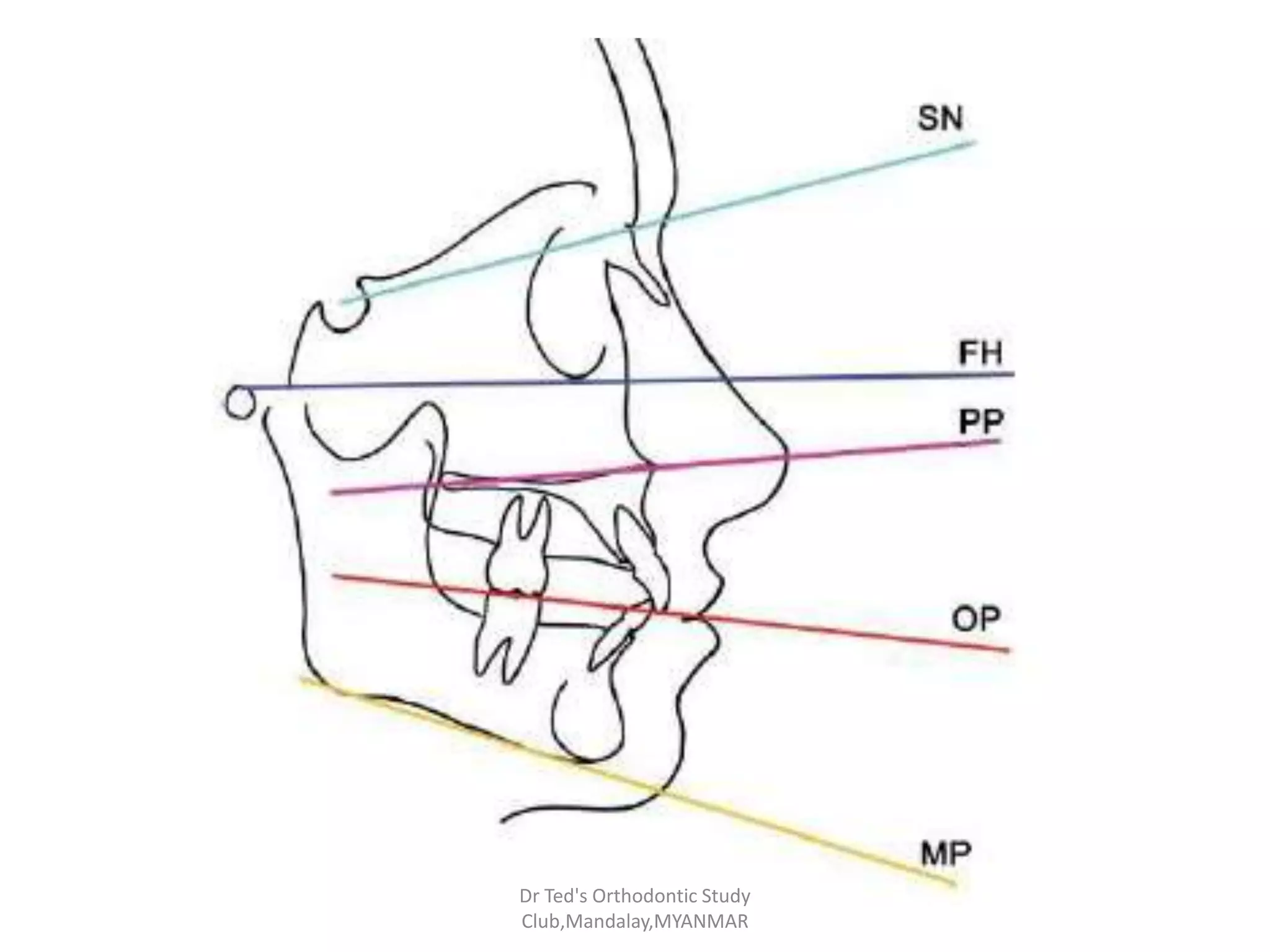 Practical cephalometric tracing | PPTX