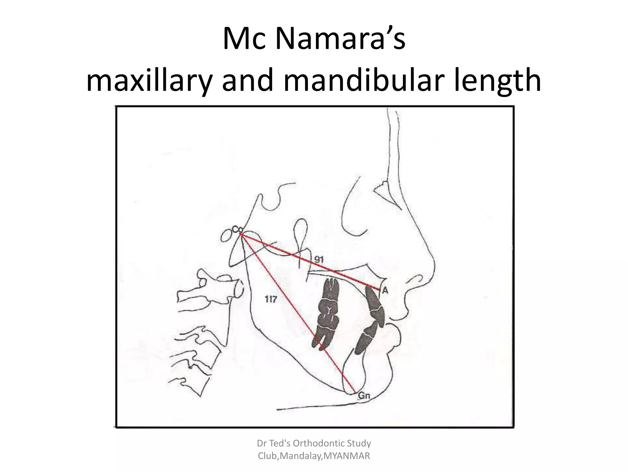Practical cephalometric tracing | PPTX