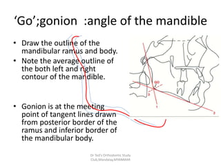 Practical cephalometric tracing | PPTX