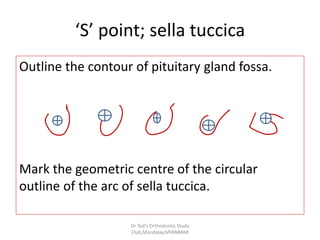 Practical cephalometric tracing | PPTX