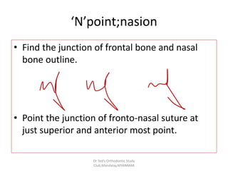 Practical cephalometric tracing | PPTX