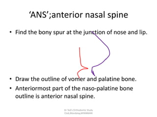 Practical cephalometric tracing | PPTX