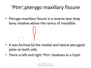 Practical cephalometric tracing | PPTX