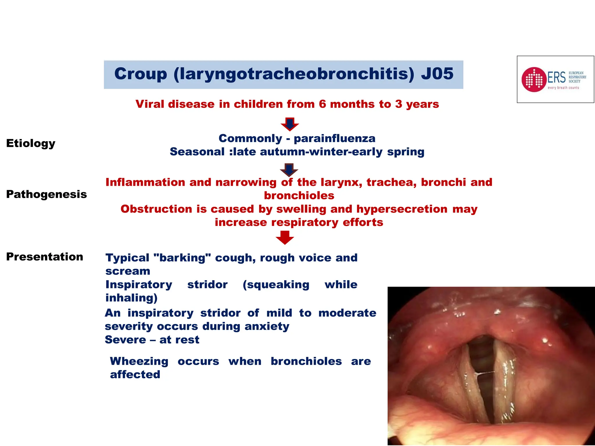 Differential diagnosis of cough in pediatric patients | PDF