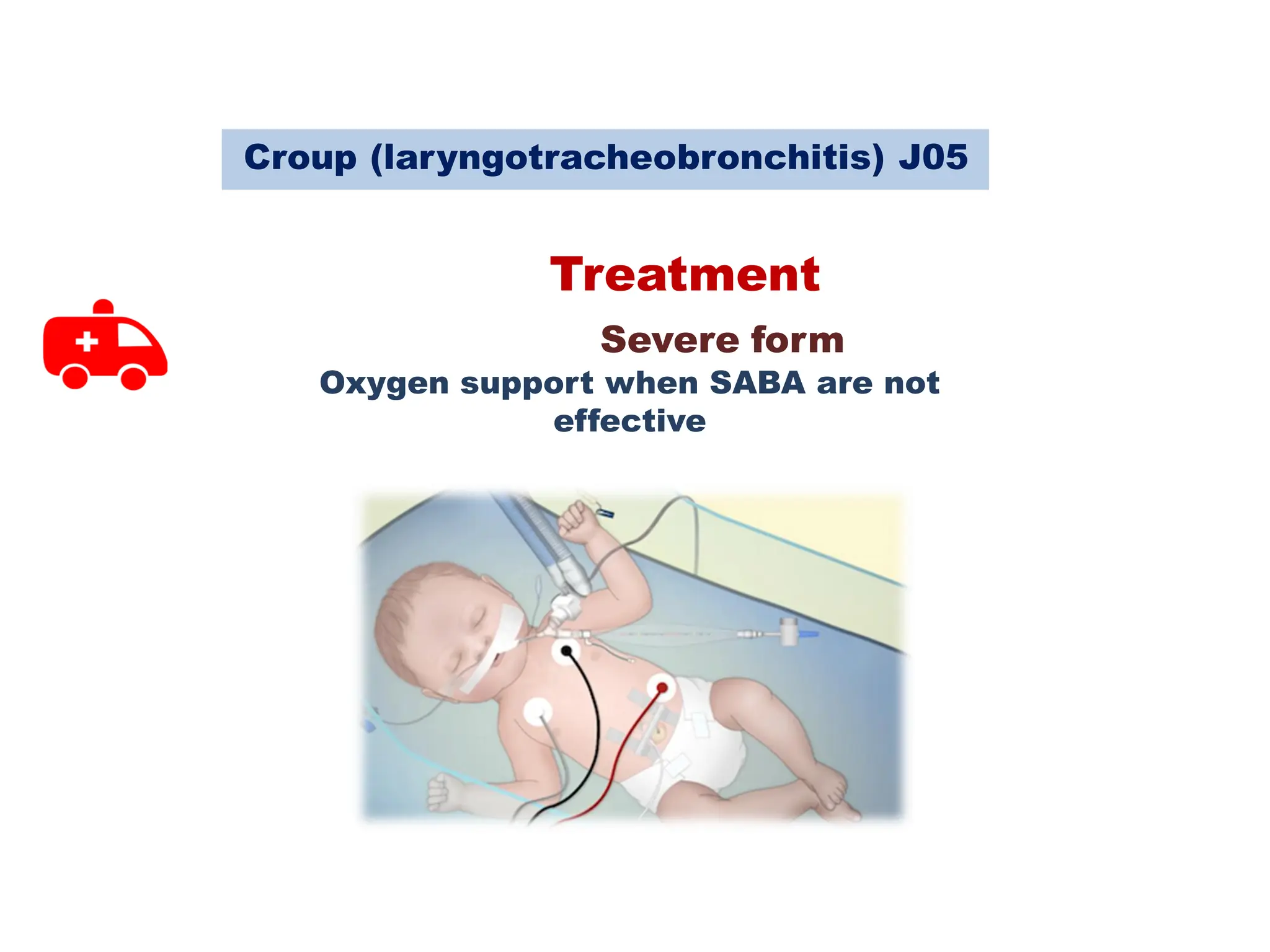 Differential diagnosis of cough in pediatric patients | PDF