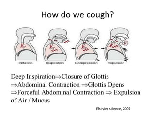 Differential diagnosis of cough in pediatric patients | PDF | Lung and ...
