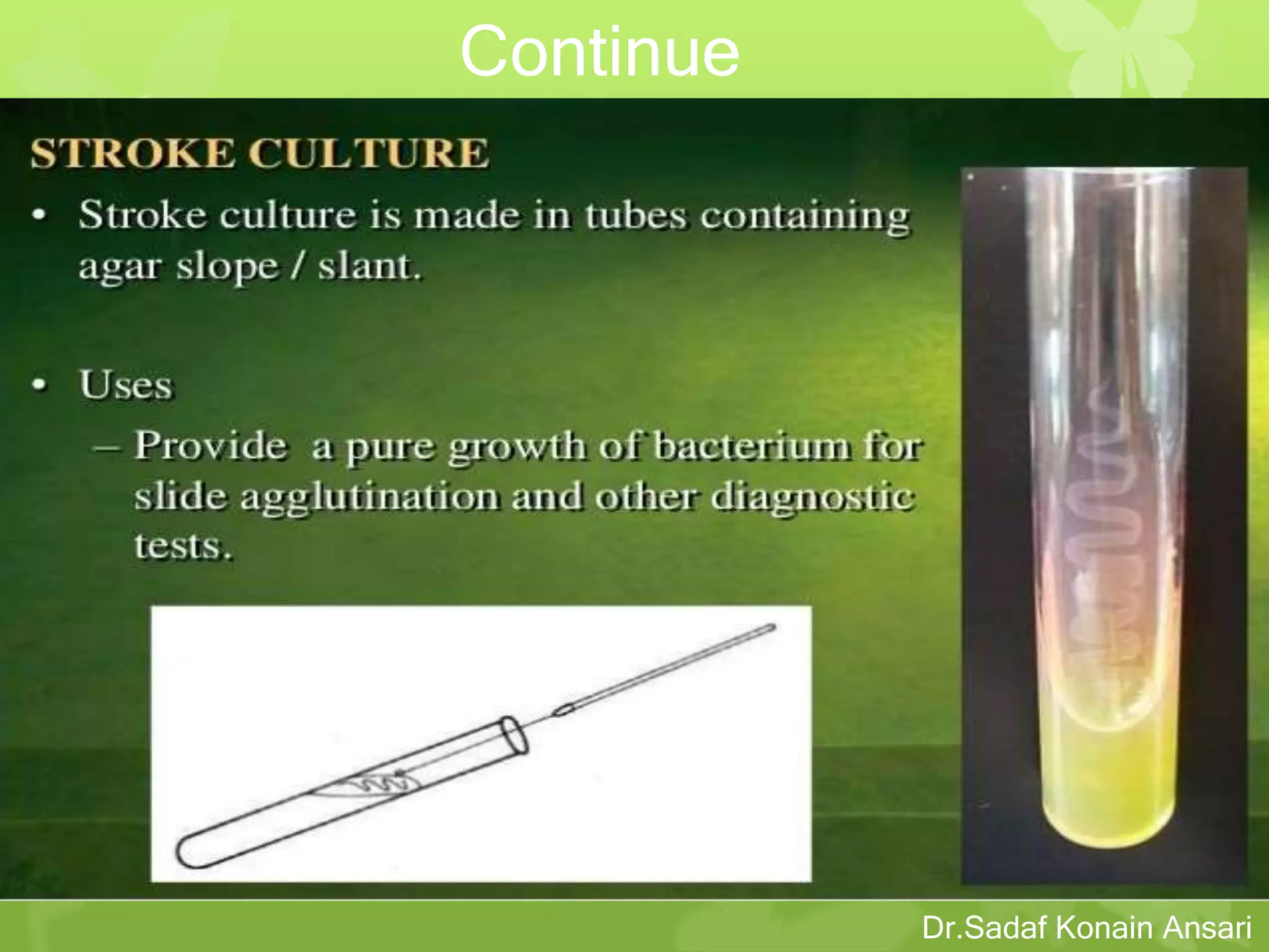 Practical culture media and culture methods 3rd yr MBBS $ 2nd yr BDS | PPT