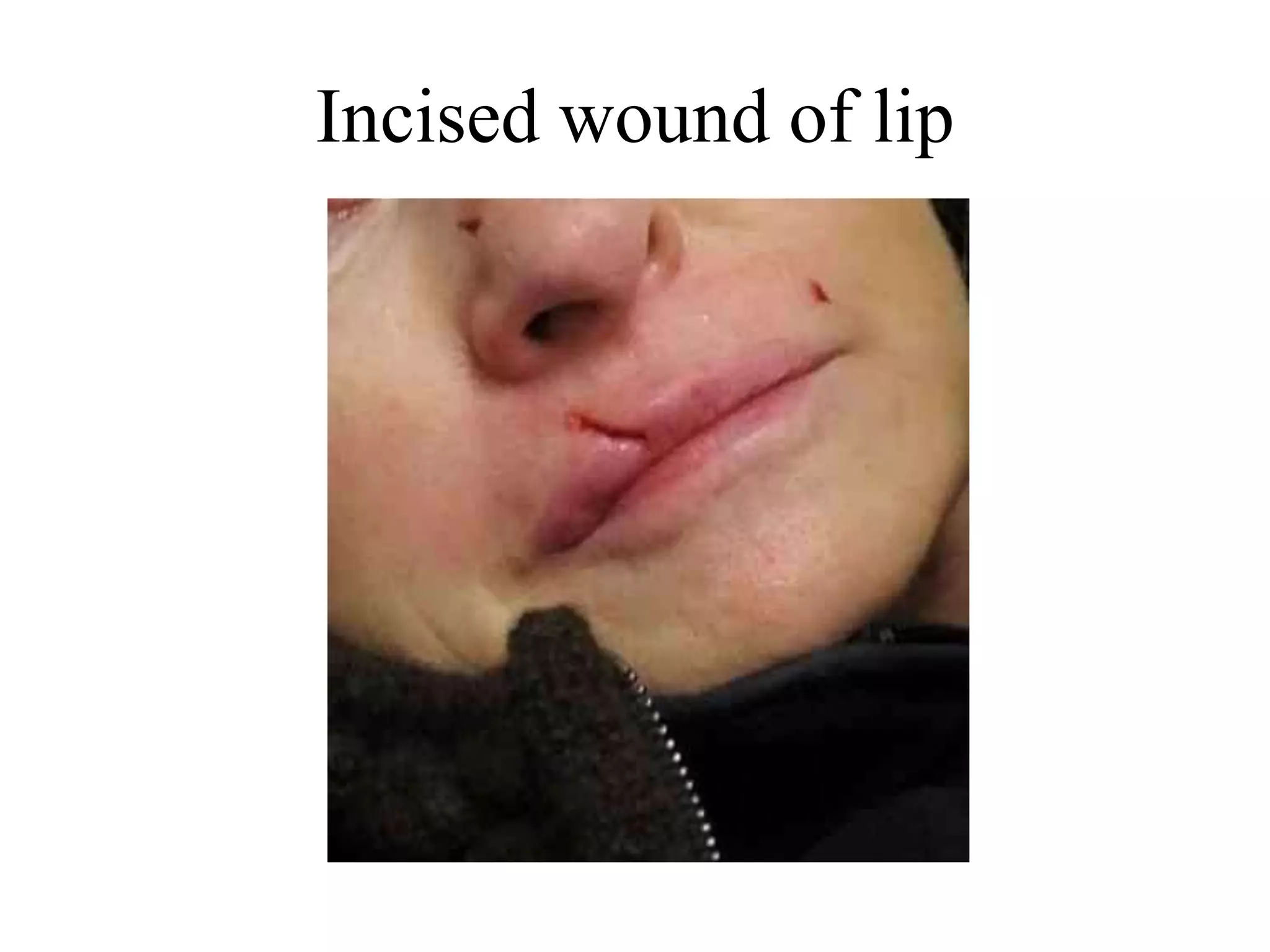 Practical general surgery | PPTX