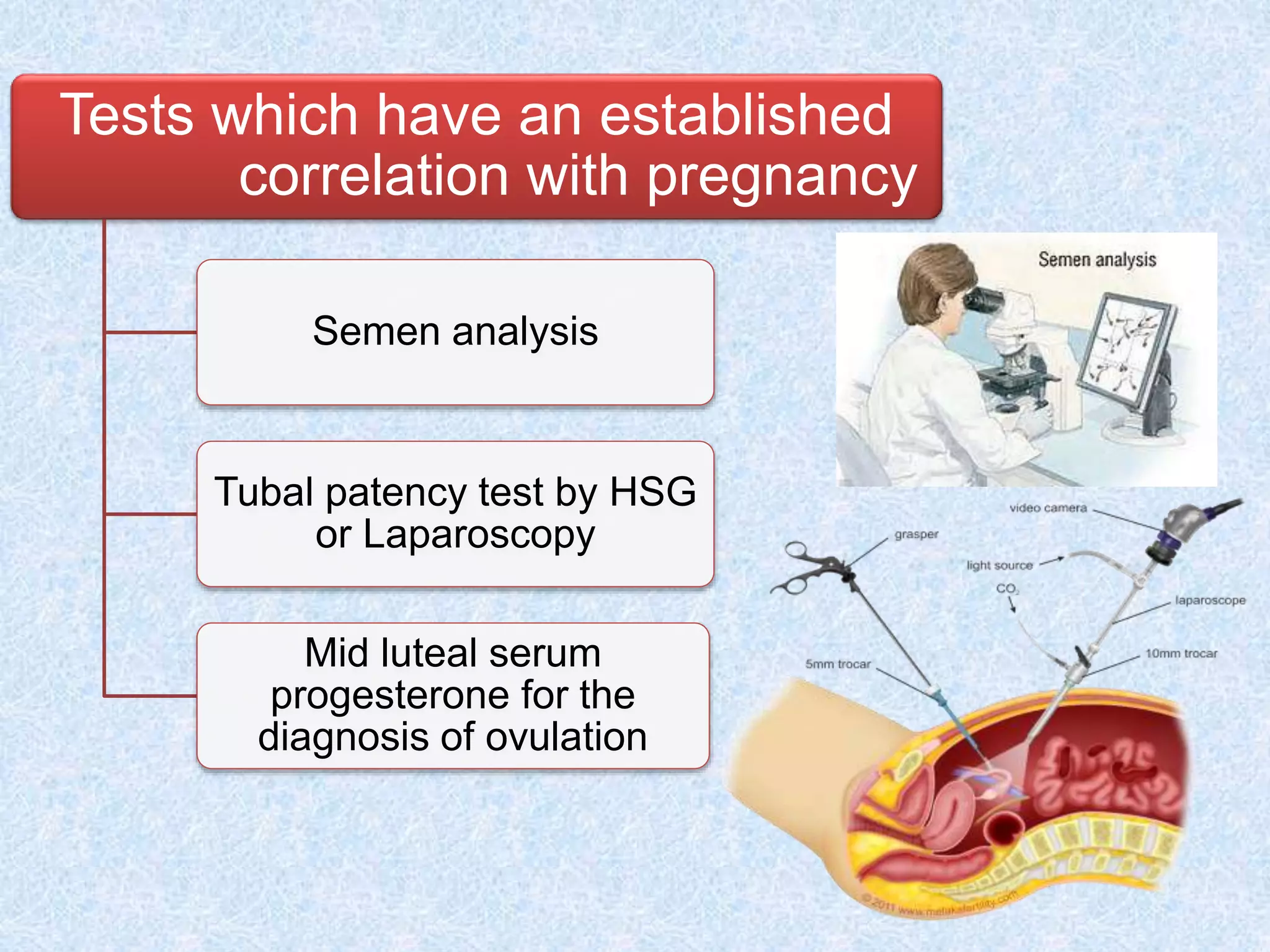 Practical guide lines for evaluation of male infertilty. | PPTX ...