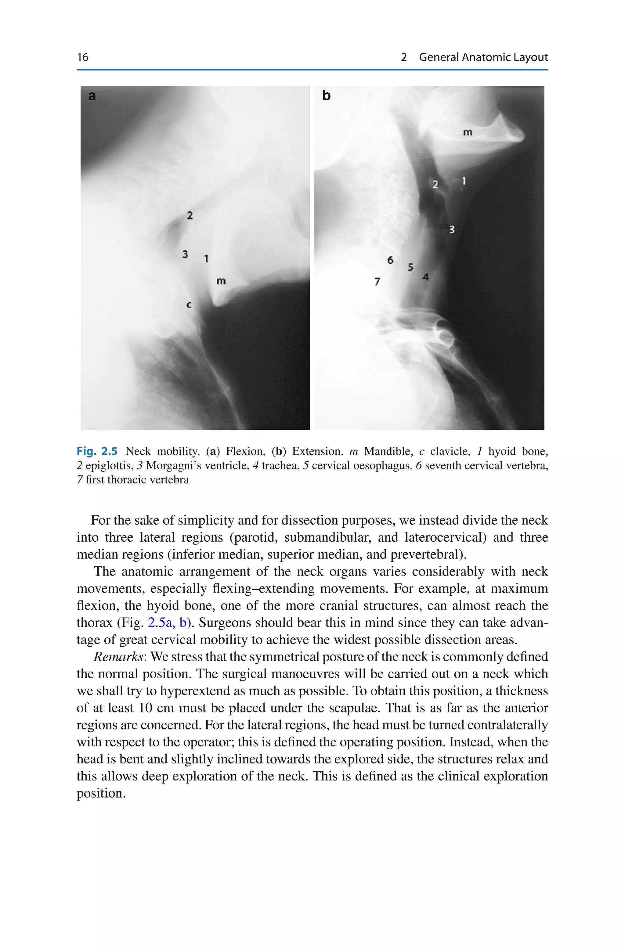 Practical guide to neck dissection | PDF