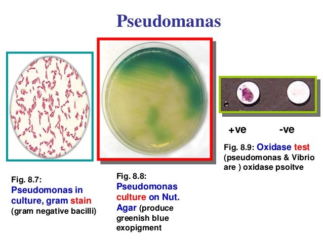 Urease Test For Pseudomonas Aeruginosa
