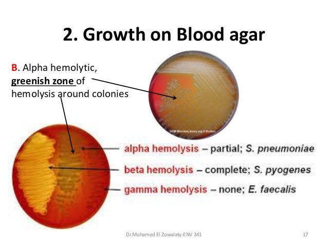 Practical microbiology Gram positive cocci