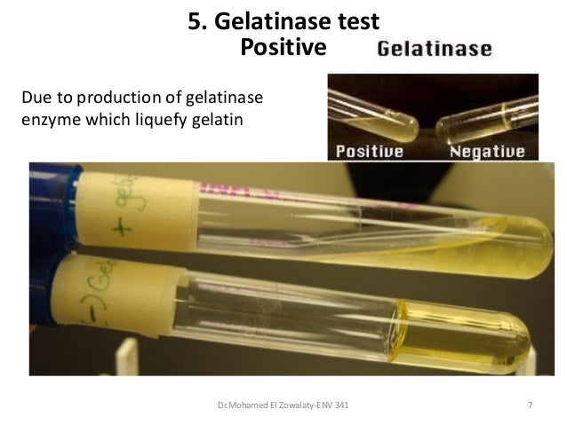 Gelatinase Production