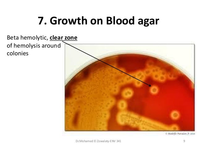 Practical microbiology Gram positive cocci
