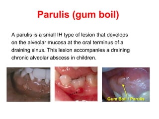 Practical oral diagnosis 2 | PPT