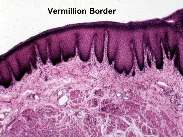 Vermilion Border Along