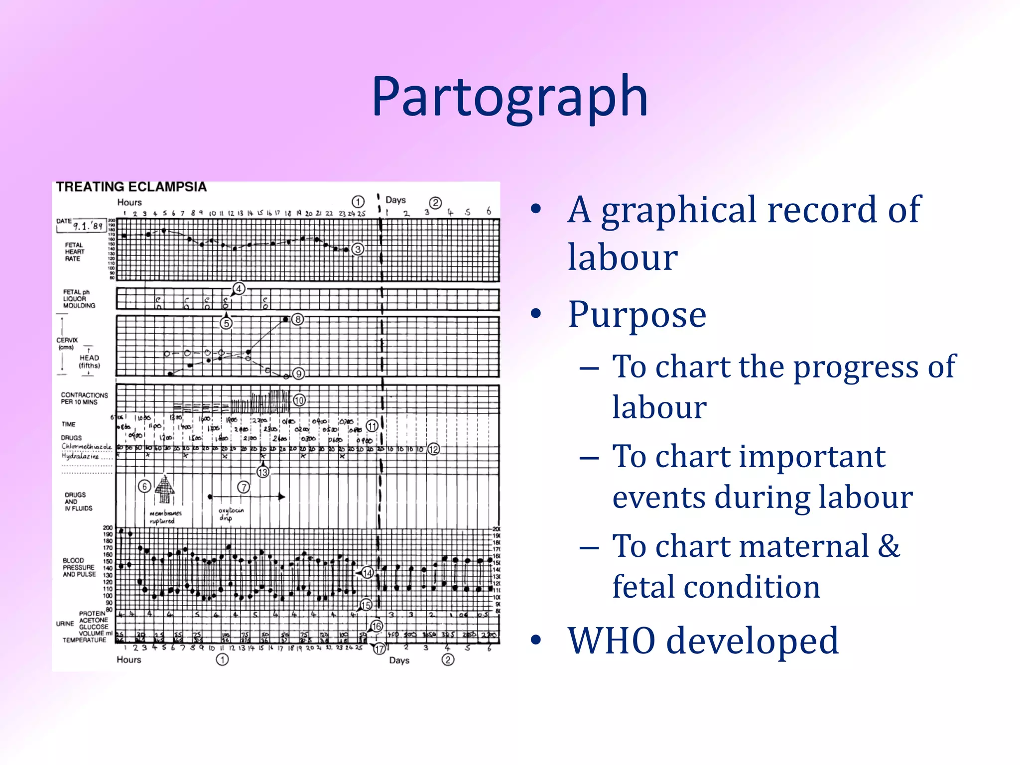 Practical partography | PDF