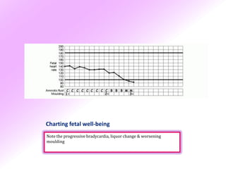 Practical partography | PDF